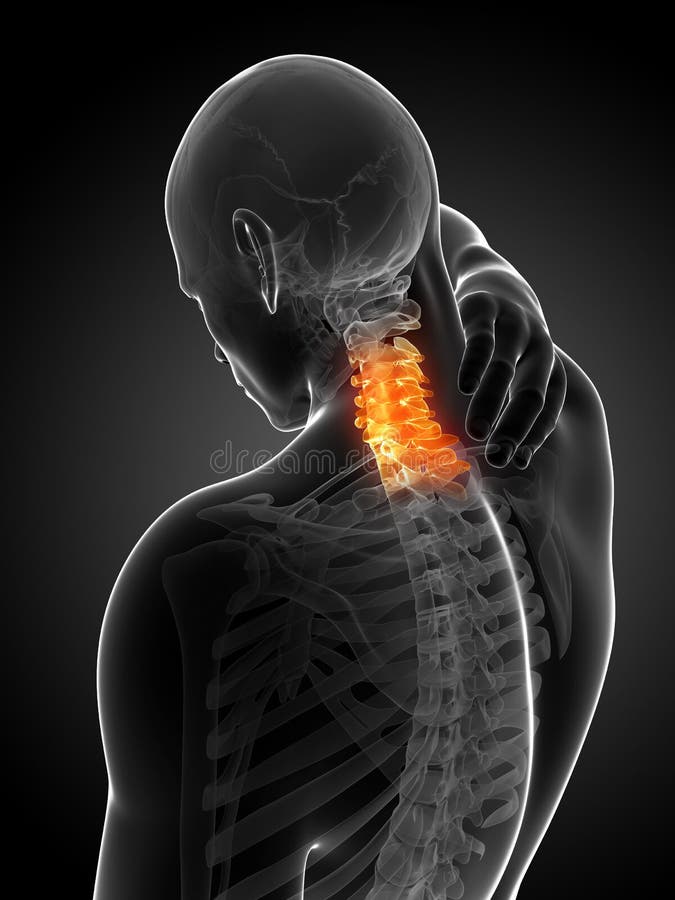 Anatomy of Male Back and Neck Pain in Blue Stock Illustration ...