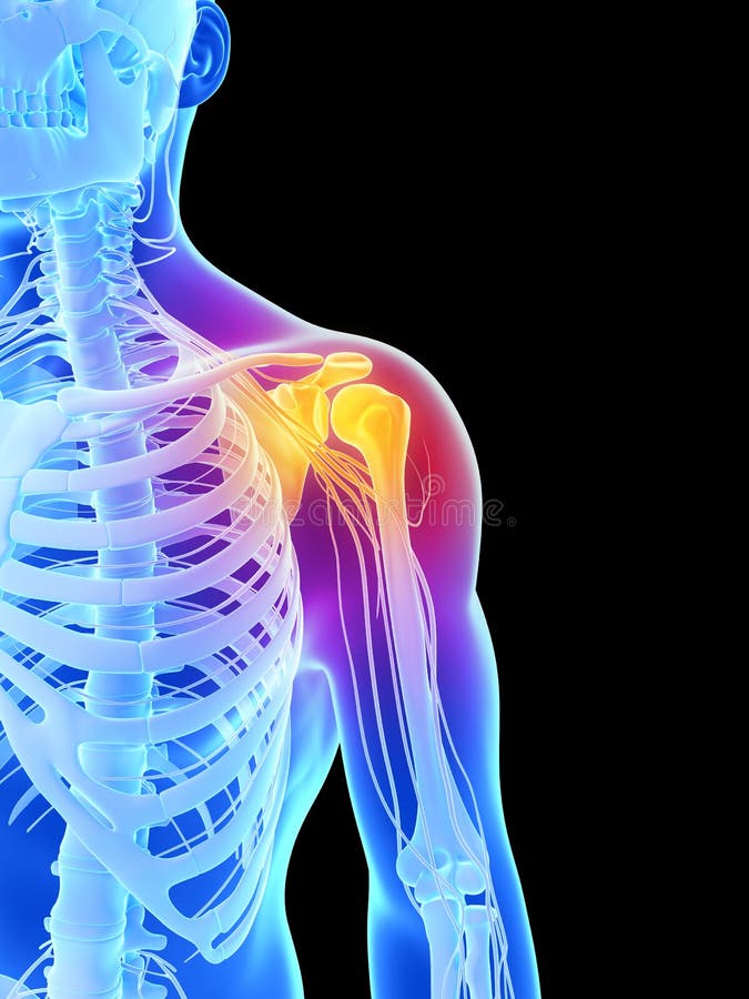 Female Skeleton with Shoulder Pain Stock Illustration - Illustration of ...