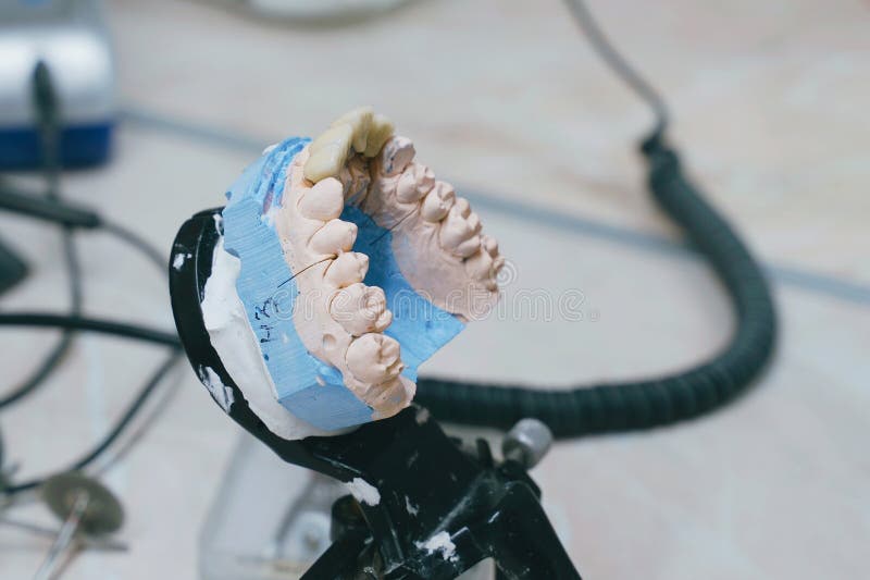 Detailed Denture Model Positioned for Dental Examination in a Workshop ...