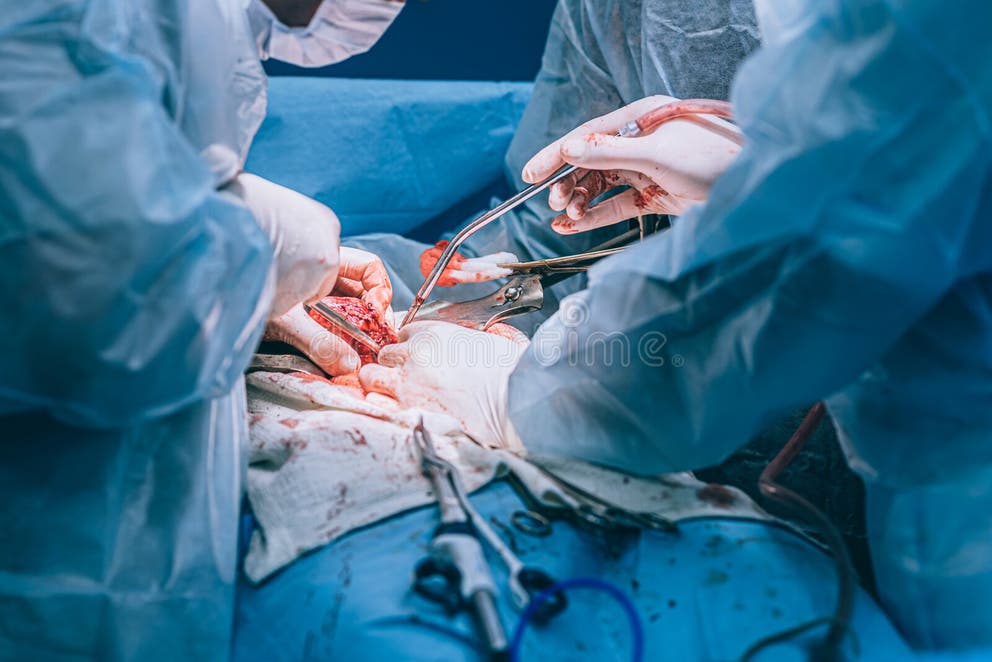 A Highly Qualified Team of Surgeons Performs a Complex Operation To ...