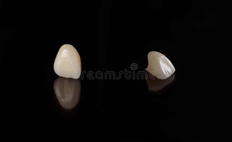 Highly-quality Ceramic Dental Crowns on Black Background, Tooth ...