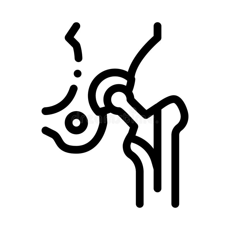 Hip Implant Replacement Biomaterial Doodle Icon Hand Drawn Illustration ...