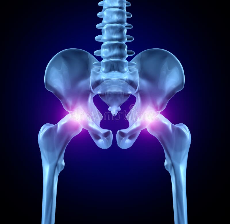 Hip Pain stock illustration. Illustration of bone, medicine - 23527249