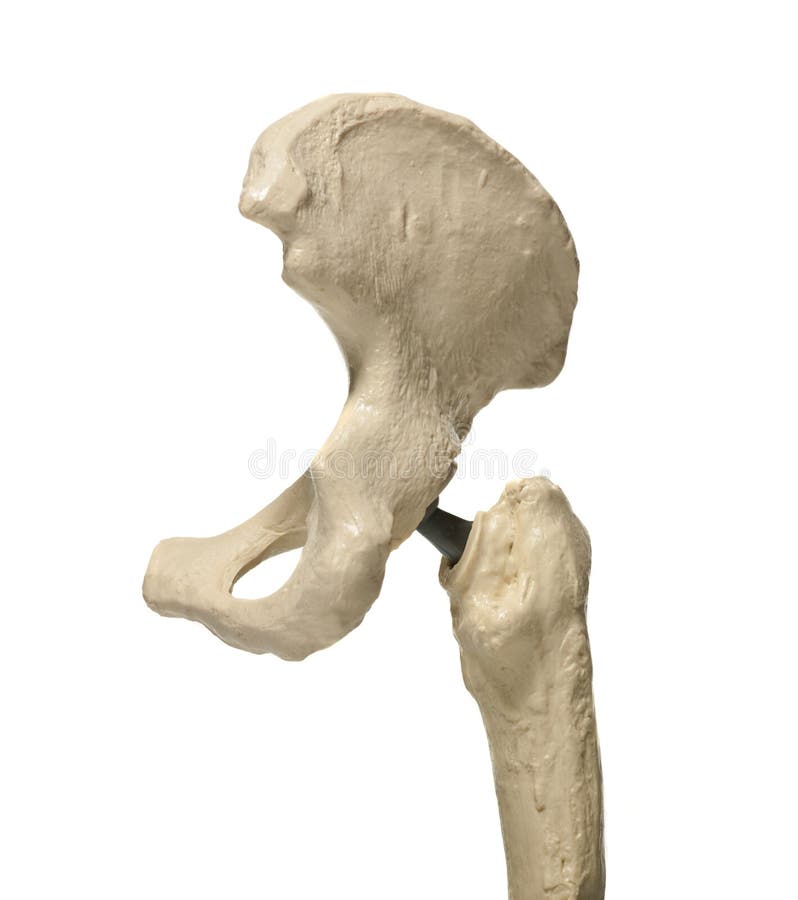 Hip replacement stock photo. Image of medical, healthy - 27730394