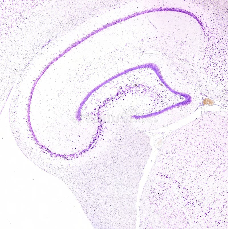 Archicortex Stock Photos - Free & Royalty-Free Stock Photos from Dreamstime