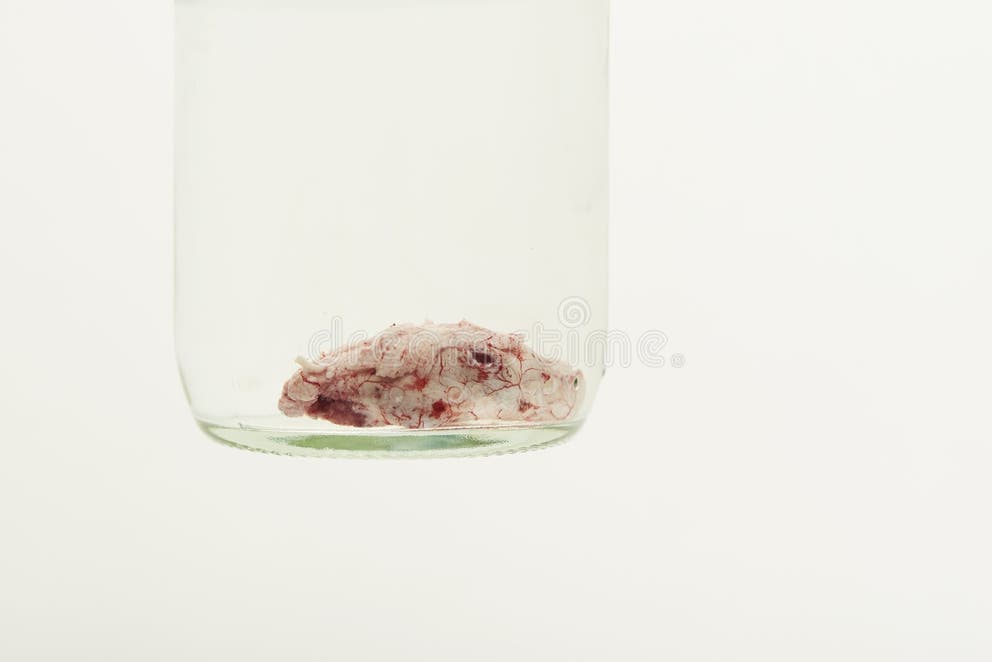 Part of Brain Specimen in Plastic Container Stock Image - Image of ...