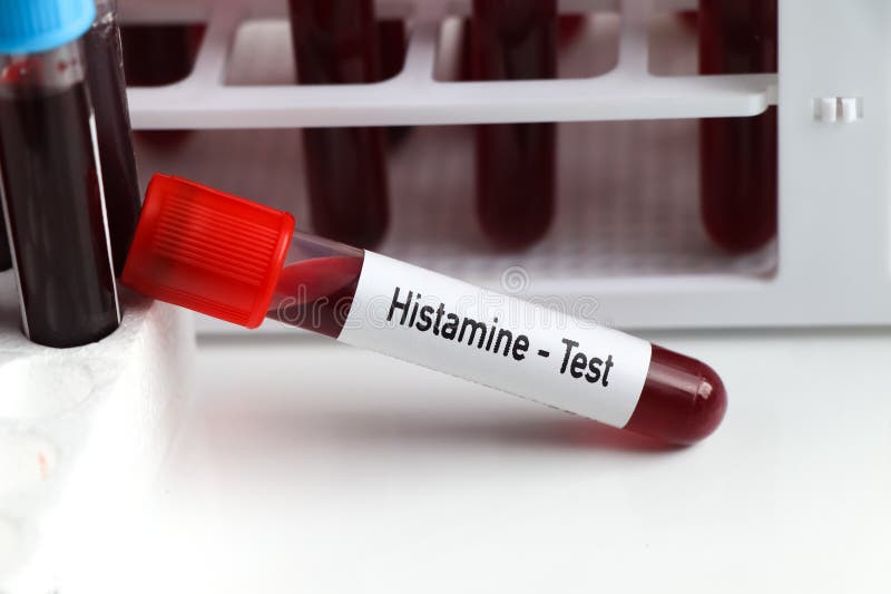 Histamine Test, Blood Sample To Analyze in the Laboratory Stock Photo ...
