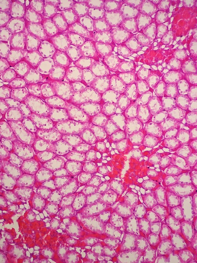 Histologia do rim humano imagem de stock. Imagem de fundo - 89484595
