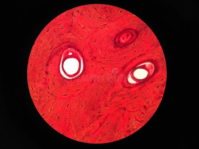 Histologia Do Tecido Compacto Humano Do Osso Imagem de Stock - Imagem ...