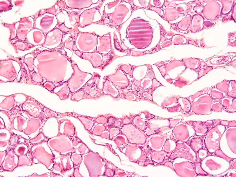 Histologia Do Tecido Humano Da Glndula De Tiroide Imagem De Stock