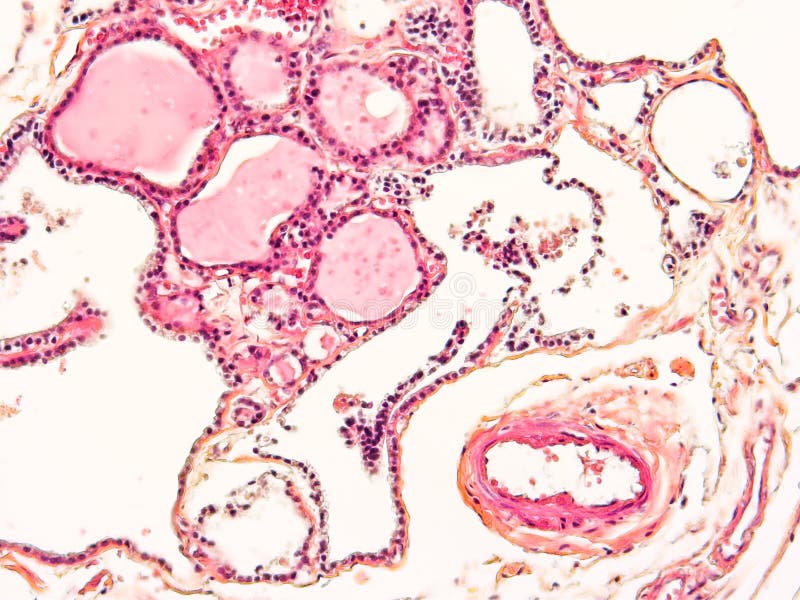 Histologia Do Tecido Humano Da Glndula De Tiroide Foto De Stock