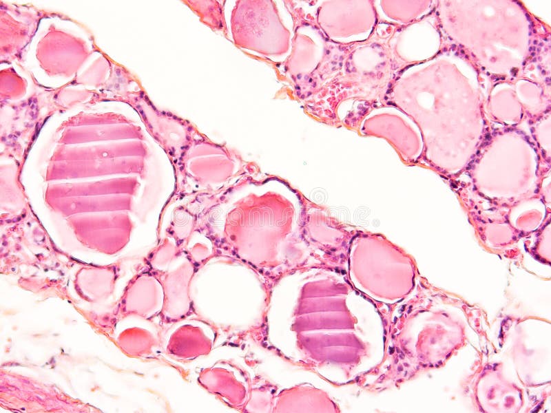 Histologia Do Tecido Humano Da Glndula De Tiroide Imagem De Stock