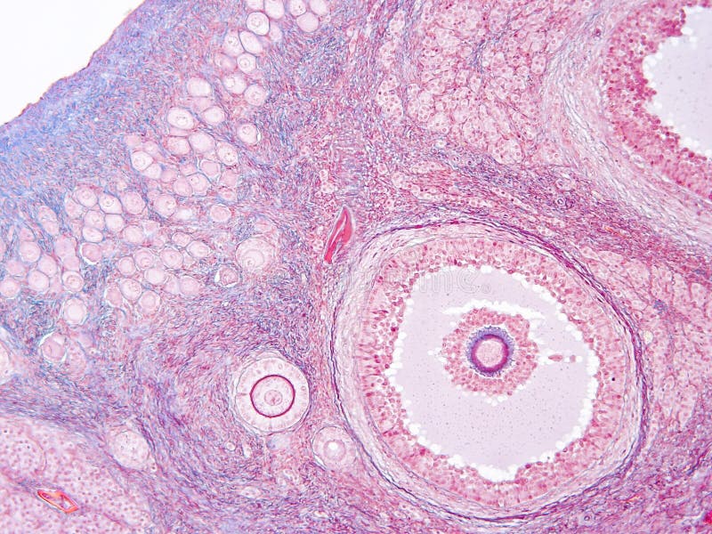 Histologia Jajnik Istoty Ludzkiej Tkanka Zdjęcie Stock Obraz Złożonej