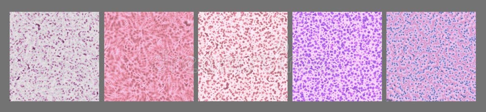 Histologic Sample Structures Set - Visualization of Tissues Cross ...