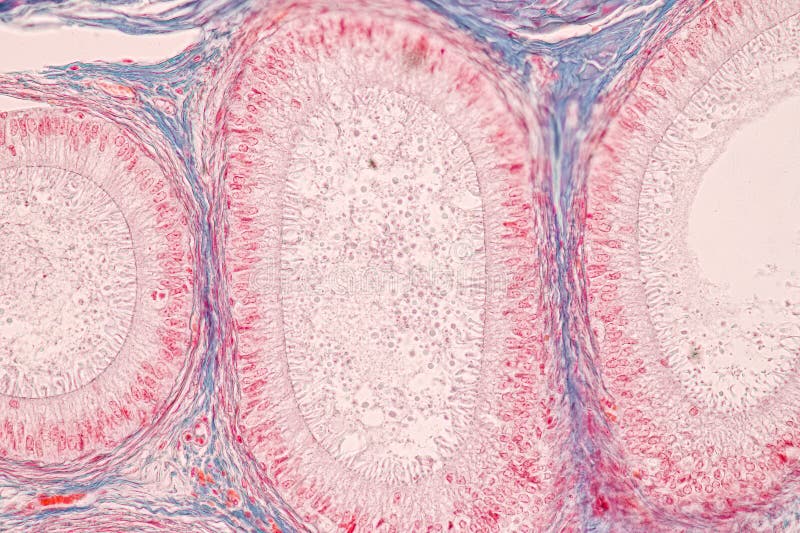 Histological Epididymis and Testis Human Cells Under Microscope. Stock ...
