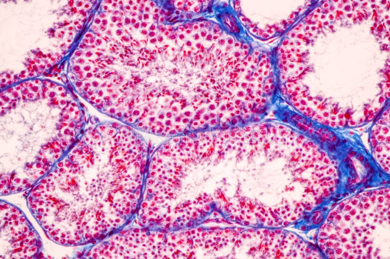 Histological Epididymis and Testis Human Cells Under Microscope. Stock ...