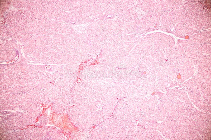 Histological Ovary, Testis and Sperm Human Cells Under Microscope ...