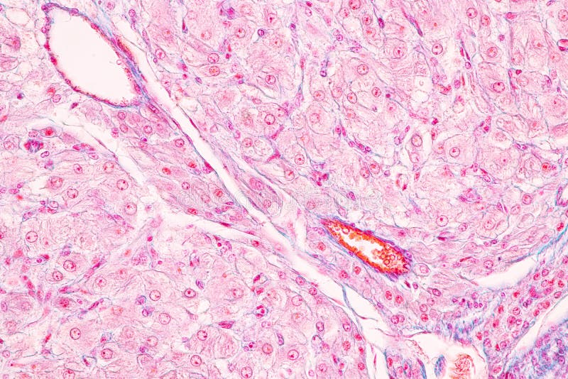 Histological Ovary, Testis and Sperm Human Cells Under Microscope ...