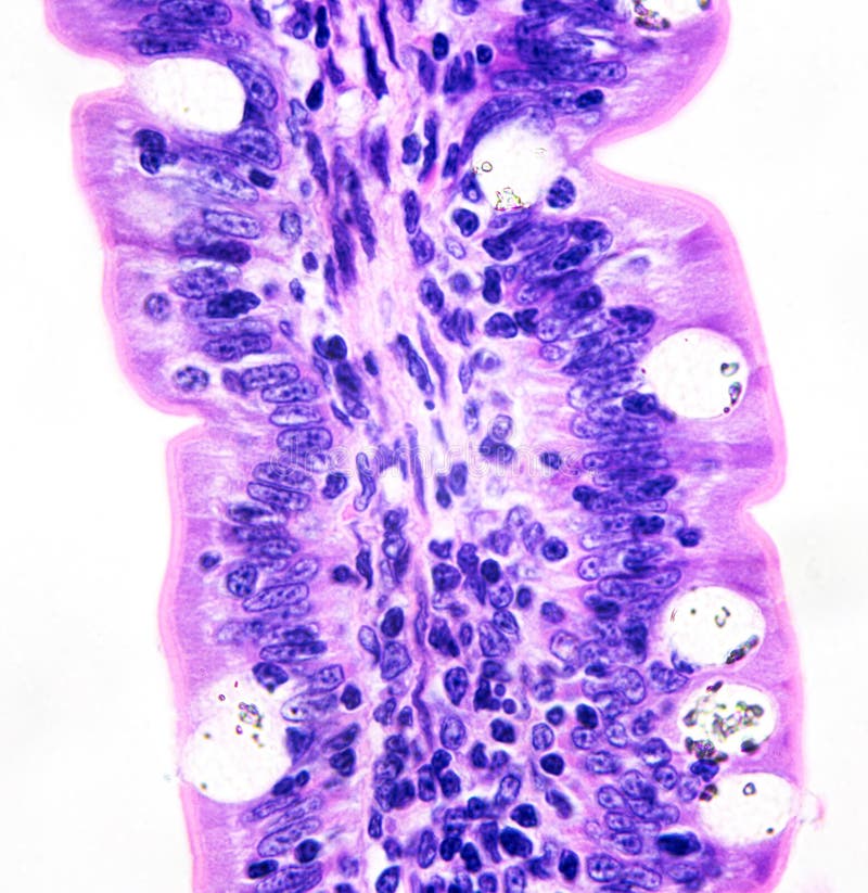 Goblet Cells of the Human Small Intestine Stock Photo - Image of ...