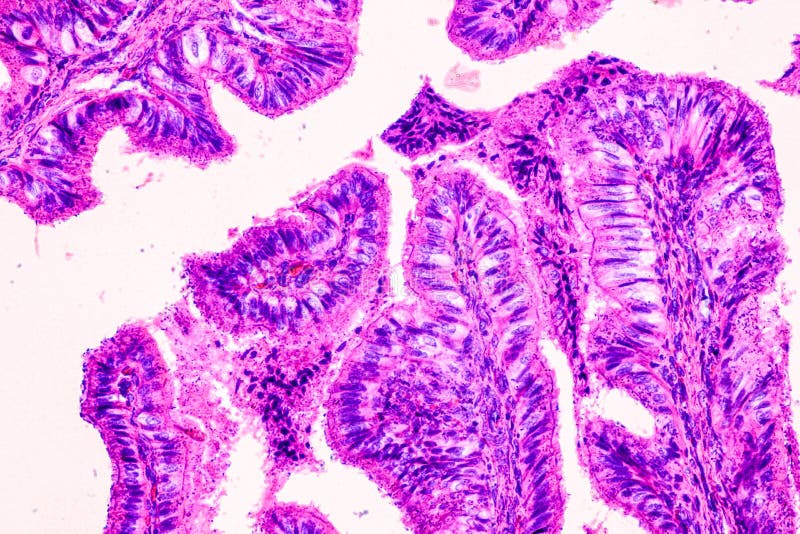 Histological Sample of Human Under the Microscope. Stock Image - Image ...