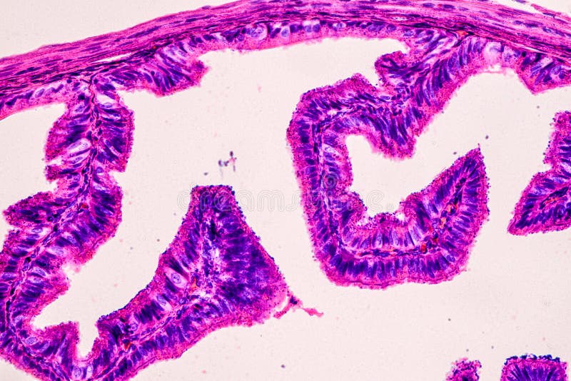 Histological Sample Of Human Under The Microscope. Stock Image - Image ...