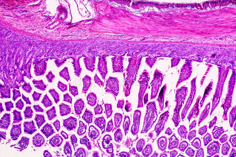 Histological Sample of Human Under the Microscope. Stock Photo - Image ...