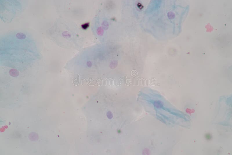 Histological Sample Squamous Epithelial Cells Under Microscope. Stock Photo - Image of ...