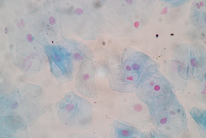 Histological Sample Squamous Epithelial Cells Under Microscope. Stock ...