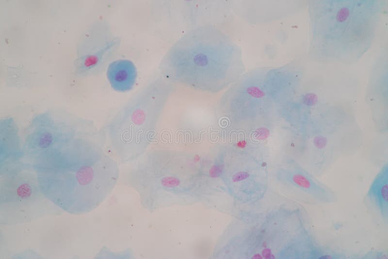 Histological Sample Squamous Epithelial Cells Under Microscope. Stock ...