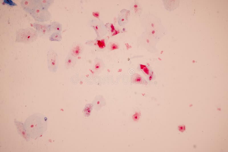 Sample Microscopy Epithelial Cells at Toby Victor blog