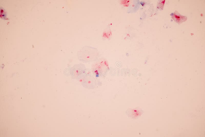 Histological Sample Squamous Epithelial Cells Under Microscope. Stock ...