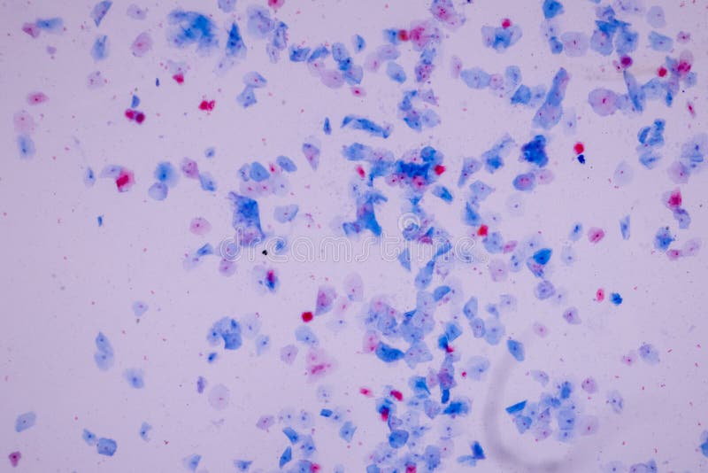 Histological Sample Squamous Epithelial Cells Under Microscope. Stock ...