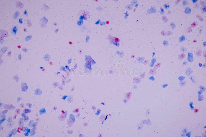 Histological Sample Squamous Epithelial Cells Under Microscope. Stock ...