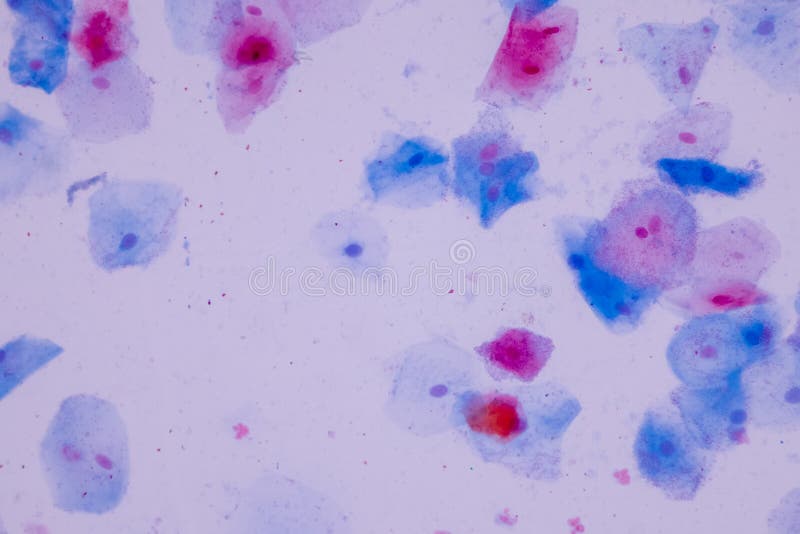 Histological Sample Squamous Epithelial Cells Under Microscope. Stock ...