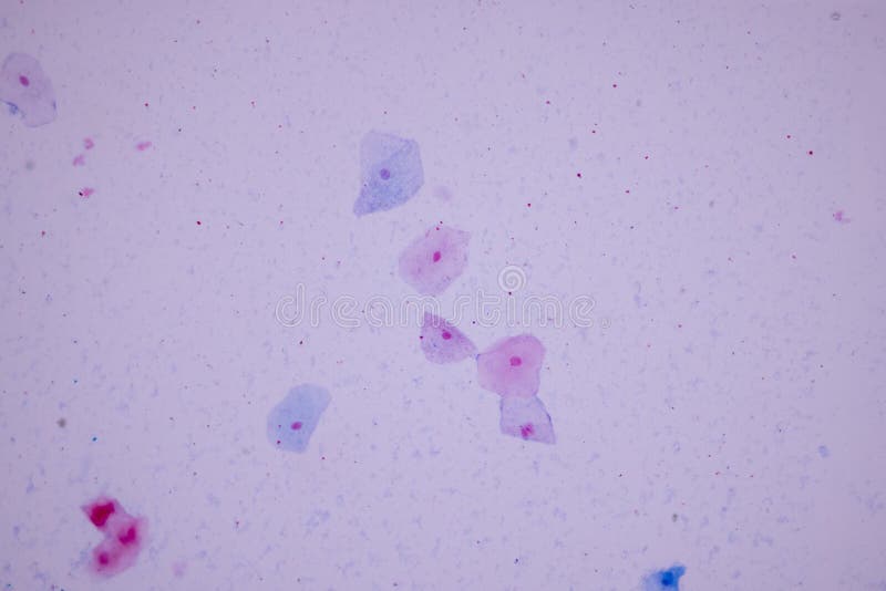 Epithelial Cells Under Microscope