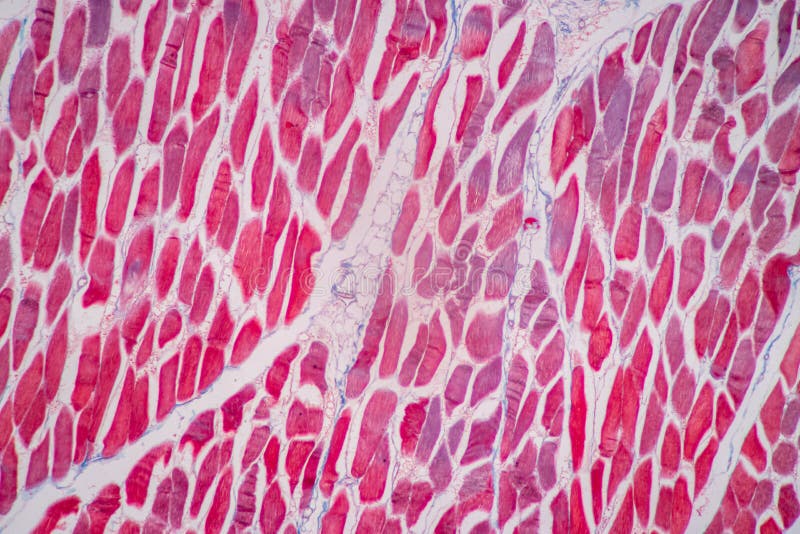 Histological Sample Striated Skeletal Muscle of Mammal Tissue Under the ...