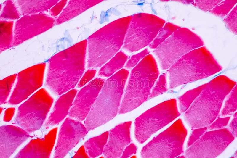 Histological Sample Striated Skeletal Muscle of Mammal Tissue Under the ...
