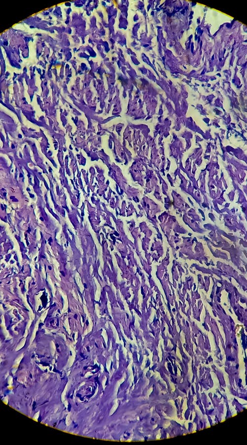 A Histological Slide of a Tissue Sample. Close Microscopic View Stock ...