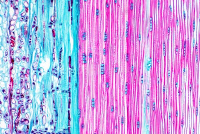 Histological Structure of Pine Stem Vascular Bundle Under Microscope ...