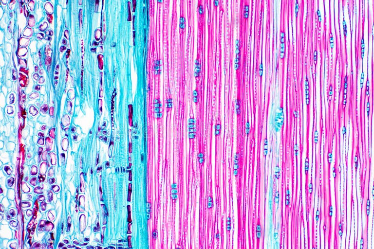Histological Structure of Pine Stem Vascular Bundle Under Microscope ...