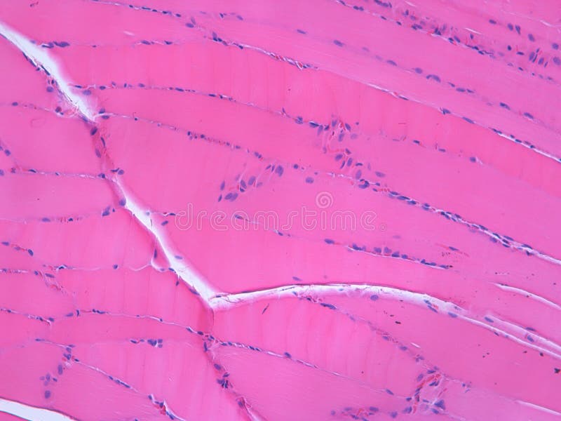 Section Longitudinale De Tissu De Muscle Squelettique Sous Un ...