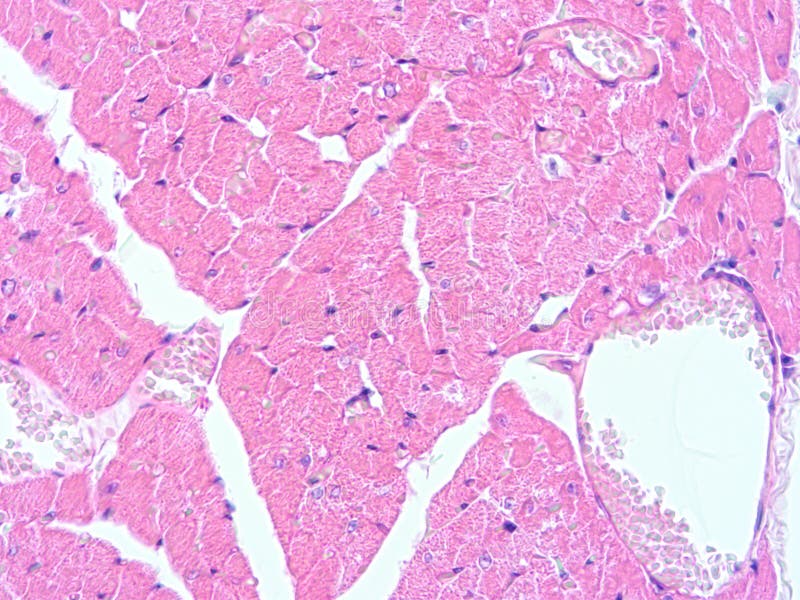 Histologie Van Hart Menselijk Weefsel Stock Afbeelding - Image of ...