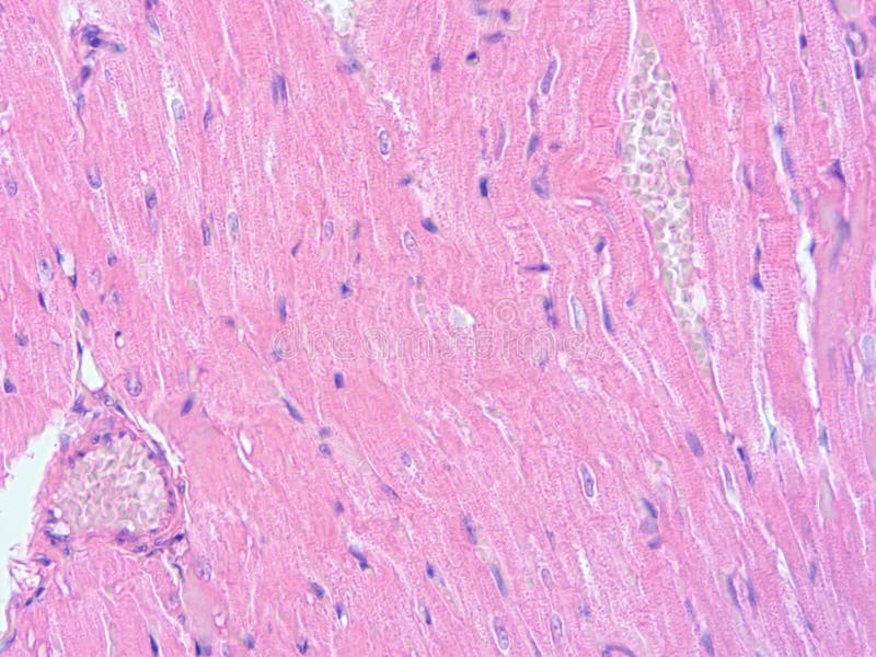 Histologie Van Hart Menselijk Weefsel Stock Foto - Image of spier ...