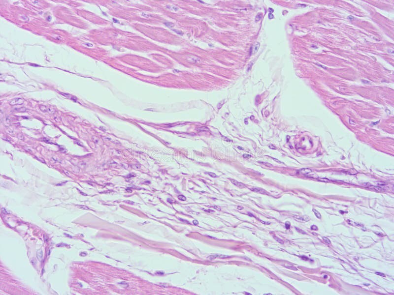 Histologie Van Hart Menselijk Weefsel Stock Foto - Image of spier ...