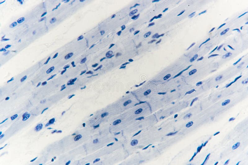 Histologie van hartspier stock foto. Image of coronair - 81547634