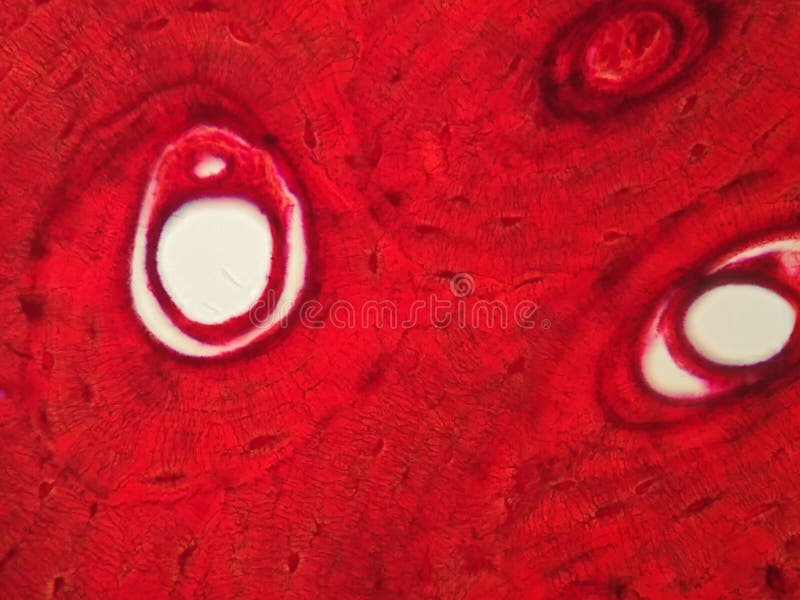 Histologie Van Menselijk Compact Beenweefsel Stock Afbeelding - Image ...