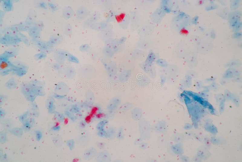 Histologisch Monster Plaveiselcel Epitheelcellen Onder Microscoop ...