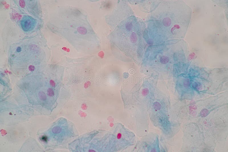 Histologisch Monster Plaveiselcel Epitheelcellen Onder Microscoop ...