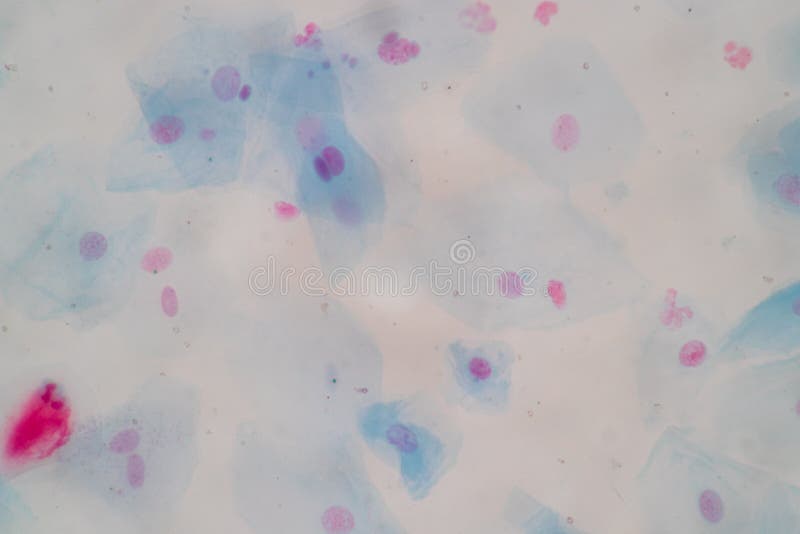 Histologisch Monster Plaveiselcel Epitheelcellen Onder Microscoop ...