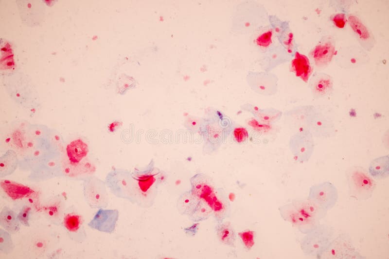 Histologisch Monster Plaveiselcel Epitheelcellen Onder Microscoop ...